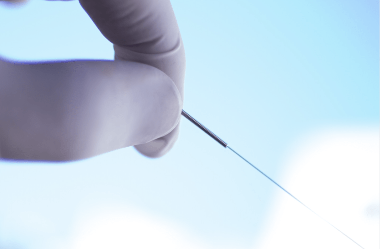 The Needle’s Edge: Transforming Pain Management with Dry Needling ...